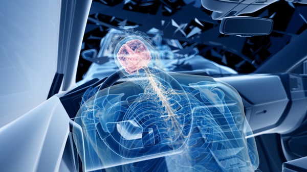 What Happens to Your Brain After a Car Accident? | Weinstein Law